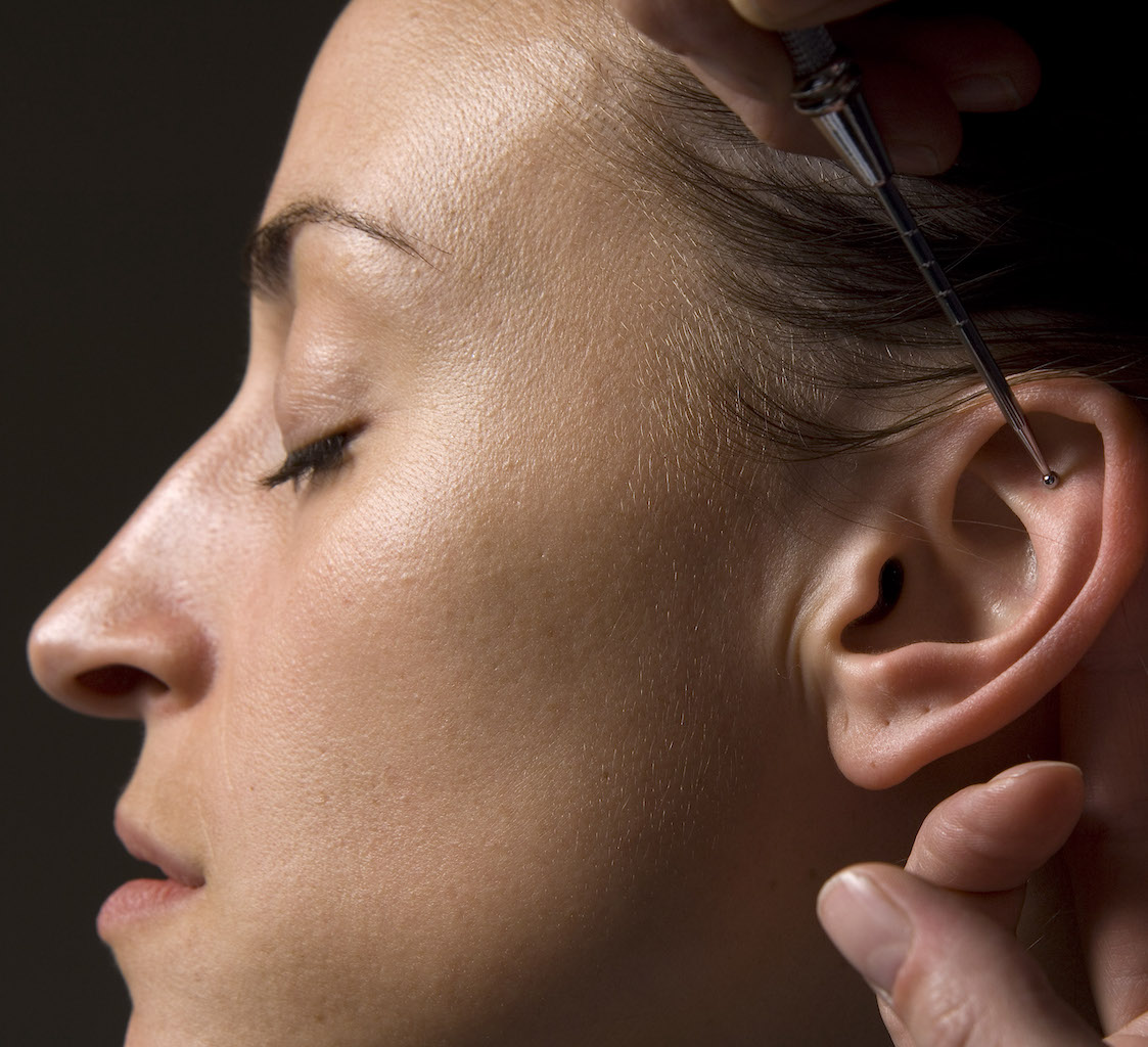 Ear Acupuncture - CPDG Limited